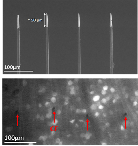 Research – James Weiland Research Group